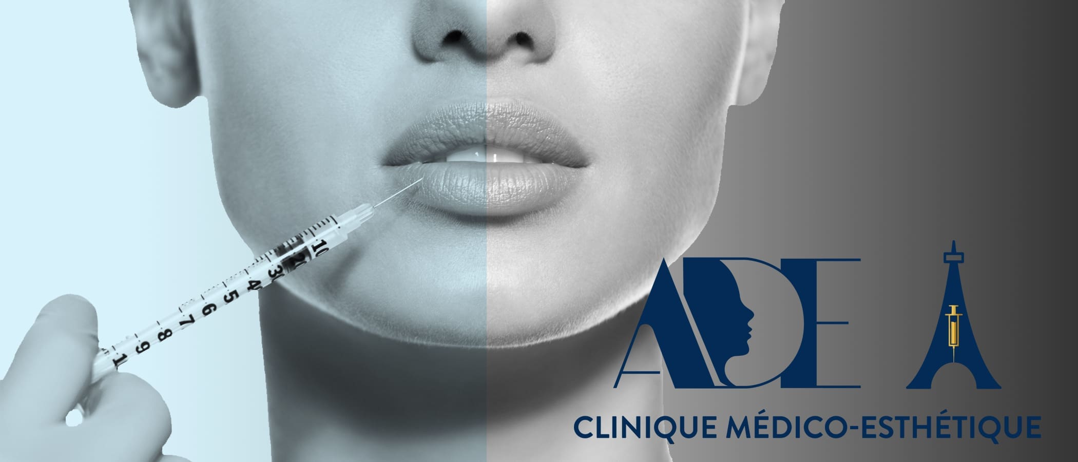 Les injectables - CLINIQUE ADE - MEDECINE ESTHETIQUE